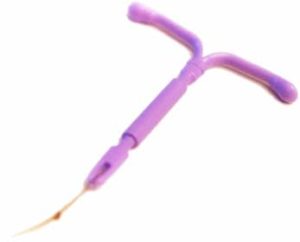 IUD Birth Control | Long-acting & Reversible Method