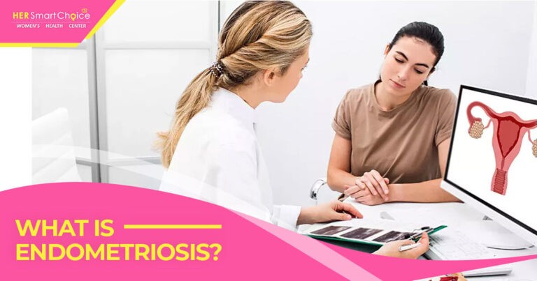 IUDs & Endometriosis: All You Need to Know - Her Smart Choice