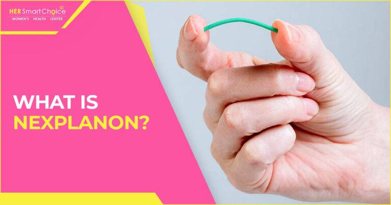 Nexplanon Birth Control: How Effective Is It for Pregnancy Prevention?