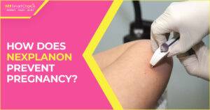 Nexplanon Birth Control: How Effective Is It for Pregnancy Prevention?